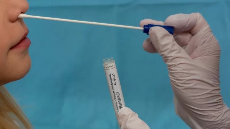 Testes para detecção de Covid e Influenza: saiba as diferenças, Cristal ...